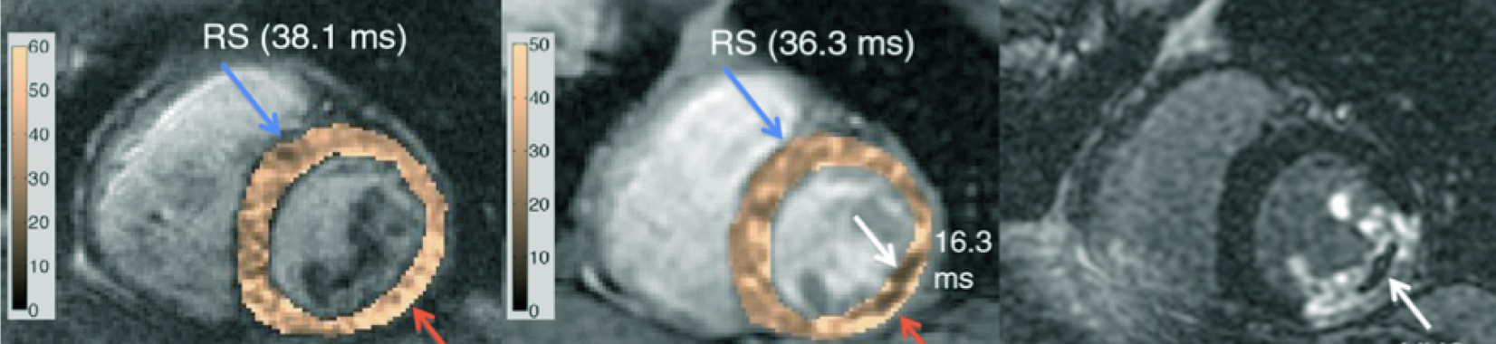 Biomedical Imaging | Medical Biophysics