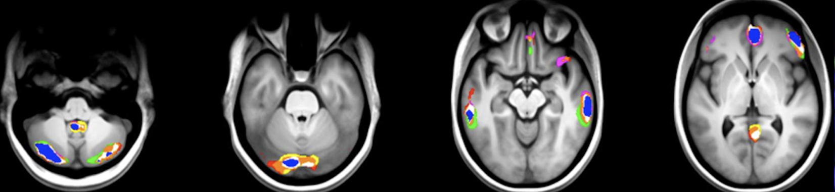 Neuroscience | Medical Biophysics